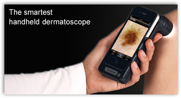 HandiScope The First Mobile Connected Dermatoscope For the IPhone ...